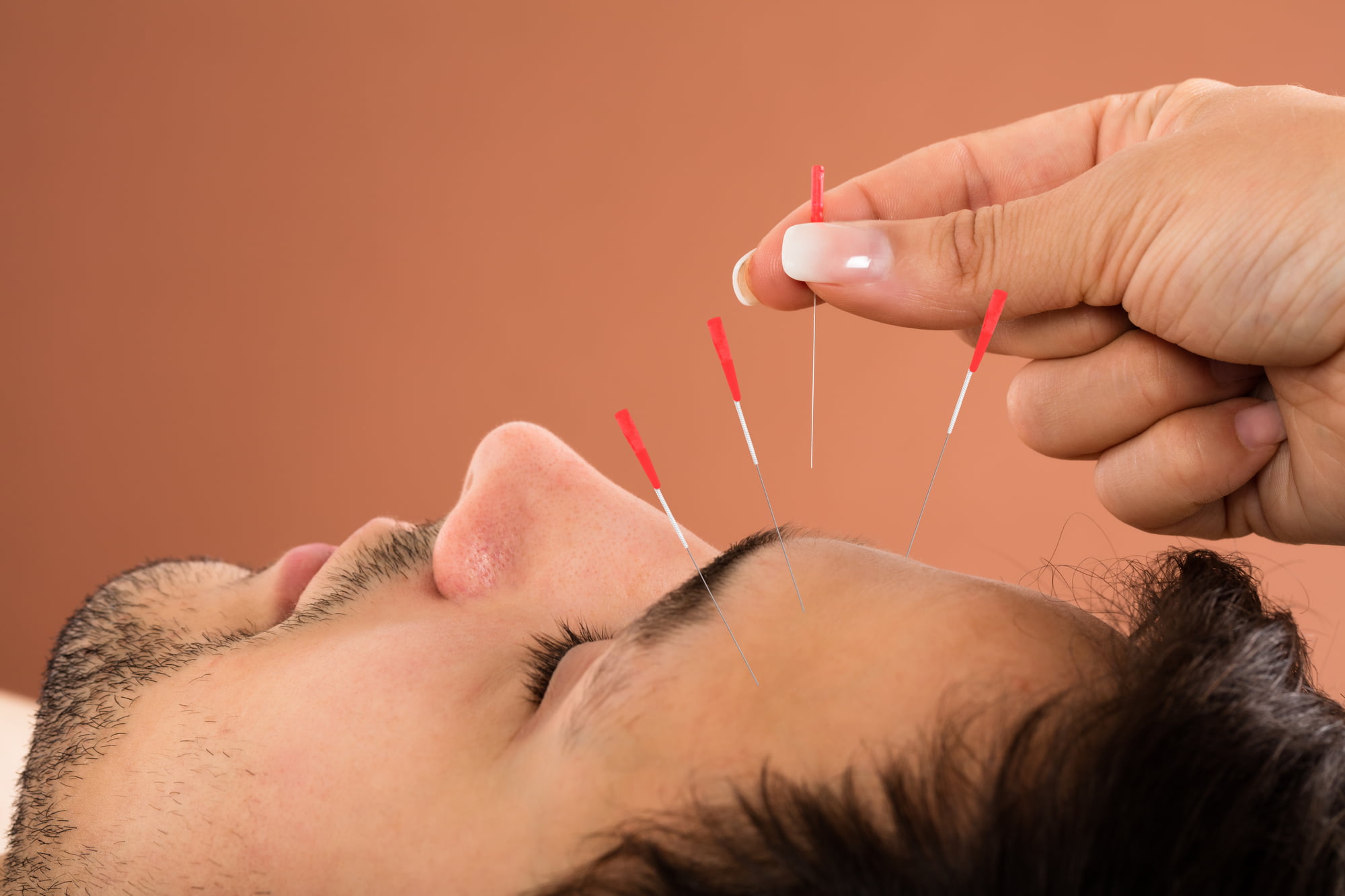 What we Treat - Best Acupuncture Denver - Acupuncturists in Denver
